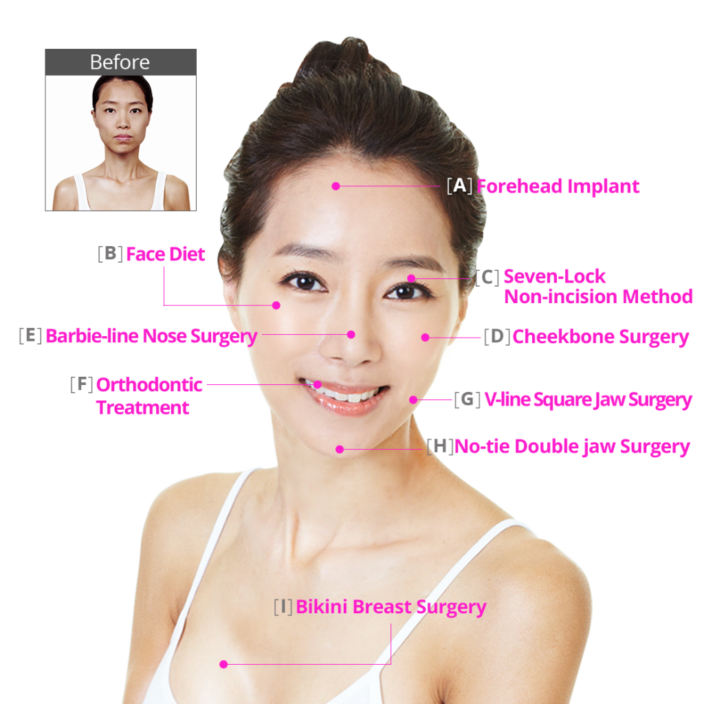 Let Me In, Park Hwa-Sung | ID Hospital