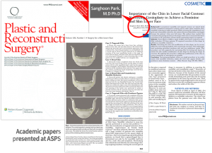 Front chin surgery【ID Hospital】