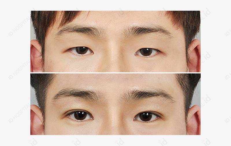 Want big, beautiful eyes? We will show you how to…