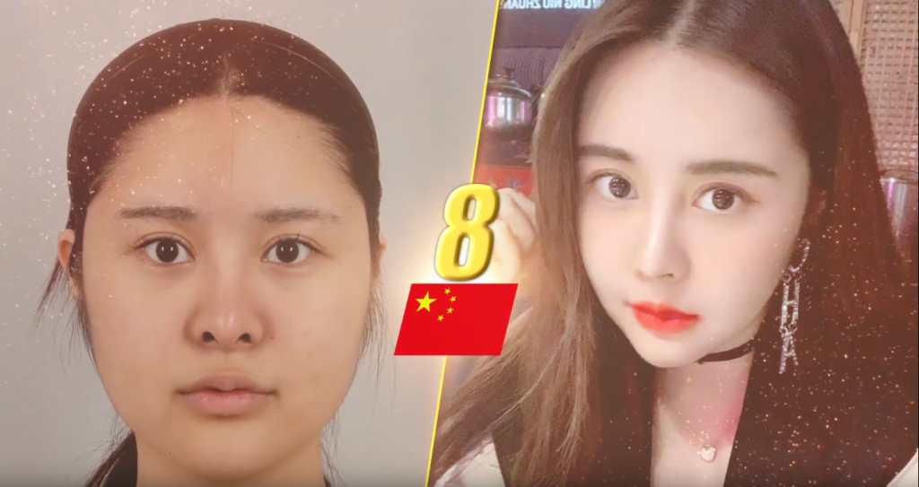 ID Hospital Korea: TOP 10 dramatic transformations after plastic ...