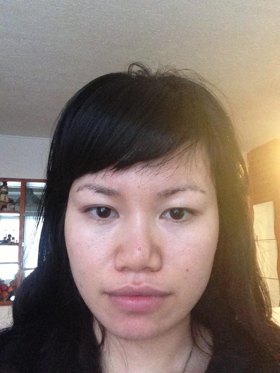 mini V-line surgery – IDHOSPITAL