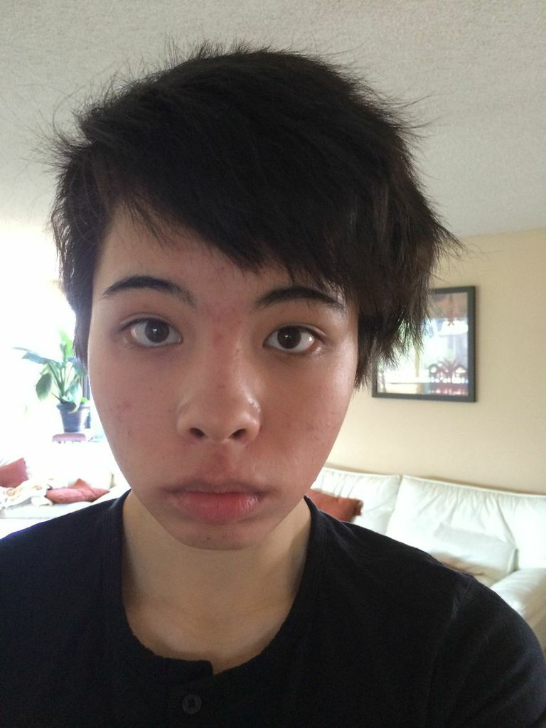 Nose extension price estimate – IDHOSPITAL